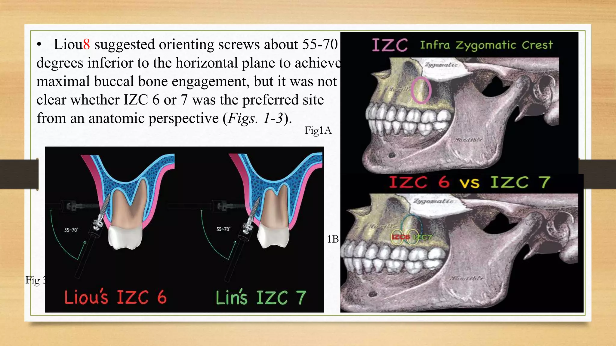 Izc screw by mahadia SAAD ALLAFY | PPTX