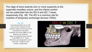 Izc screw by mahadia SAAD ALLAFY | PPTX