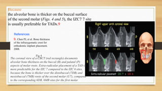 Izc screw by mahadia SAAD ALLAFY | PPTX