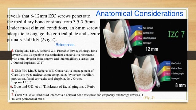 Izc screw by mahadia SAAD ALLAFY
