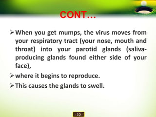 Izzatullah presentation mumps virus | PPTX