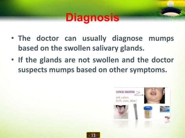 Izzatullah presentation mumps virus | PPTX | Ear, Nose and Throat ...