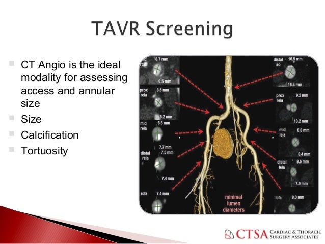 J. frederick ctsa summit tavr