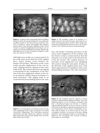 Friction in orthodontics | PDF