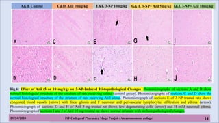 Huntington's Disease and OMKAR ISF College of Pharmacy | PPT