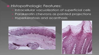 j - Epithelial Pathology.pptx