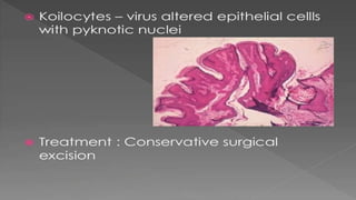 j - Epithelial Pathology.pptx