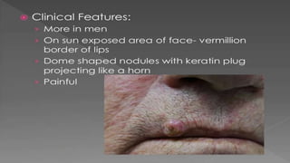 j - Epithelial Pathology.pptx