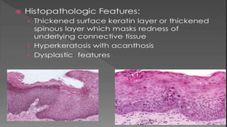 j - Epithelial Pathology.pptx