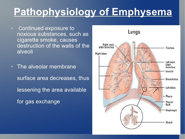 J. Parker Emphysema Presentation Powerpoint