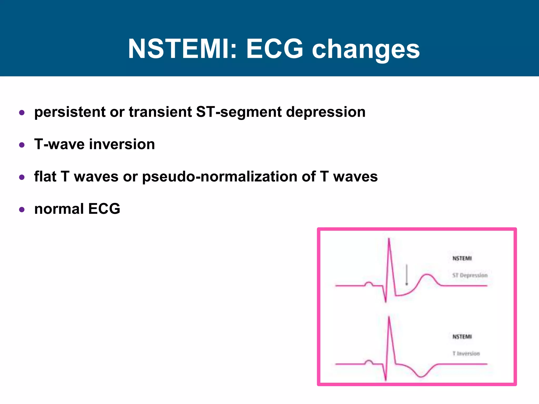 ECG interpretation: NSTEMI | PPTX