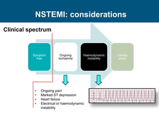 ECG interpretation: NSTEMI | PPTX
