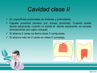 CAVIDADES EN OPERATORIA | PPTX