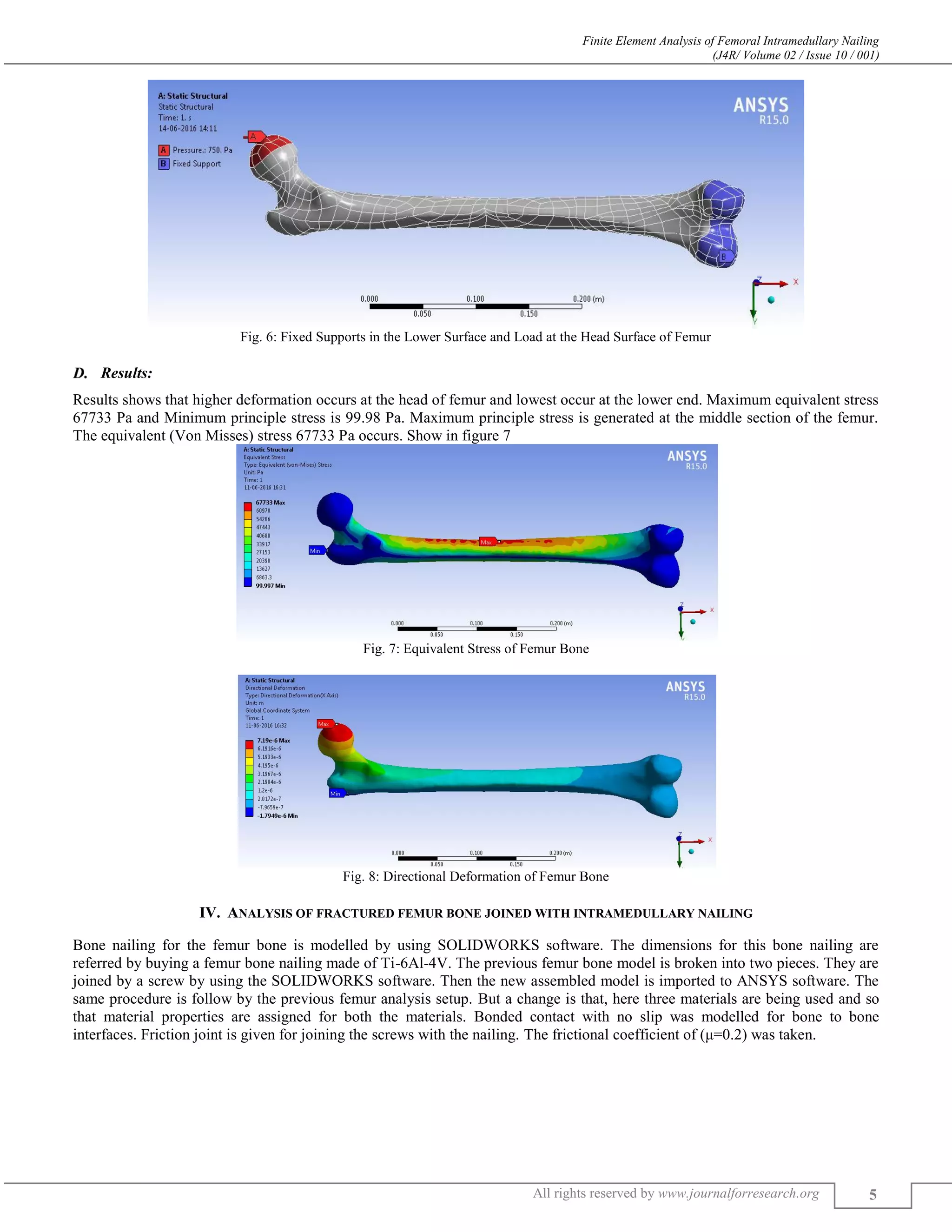 FINITE ELEMENT ANALYSIS OF FEMORAL INTRAMEDULLARY NAILING | PDF