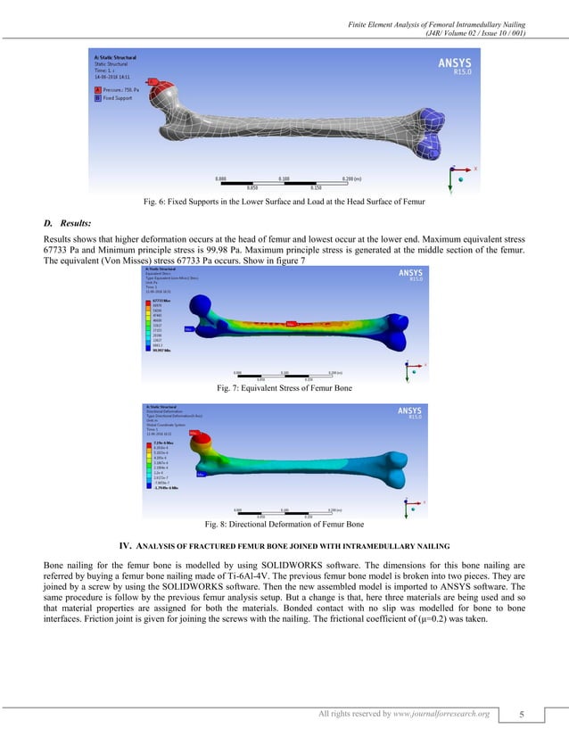 FINITE ELEMENT ANALYSIS OF FEMORAL INTRAMEDULLARY NAILING | PDF