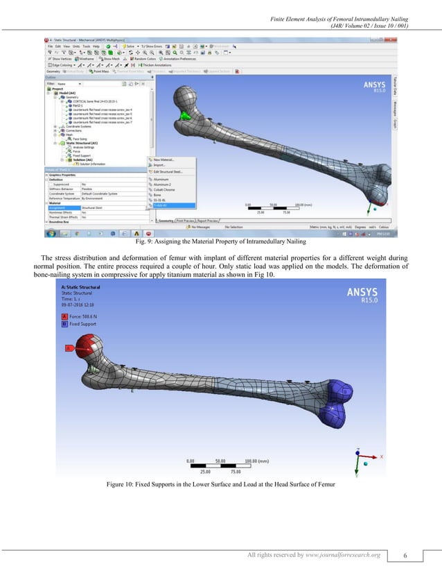 FINITE ELEMENT ANALYSIS OF FEMORAL INTRAMEDULLARY NAILING | PDF