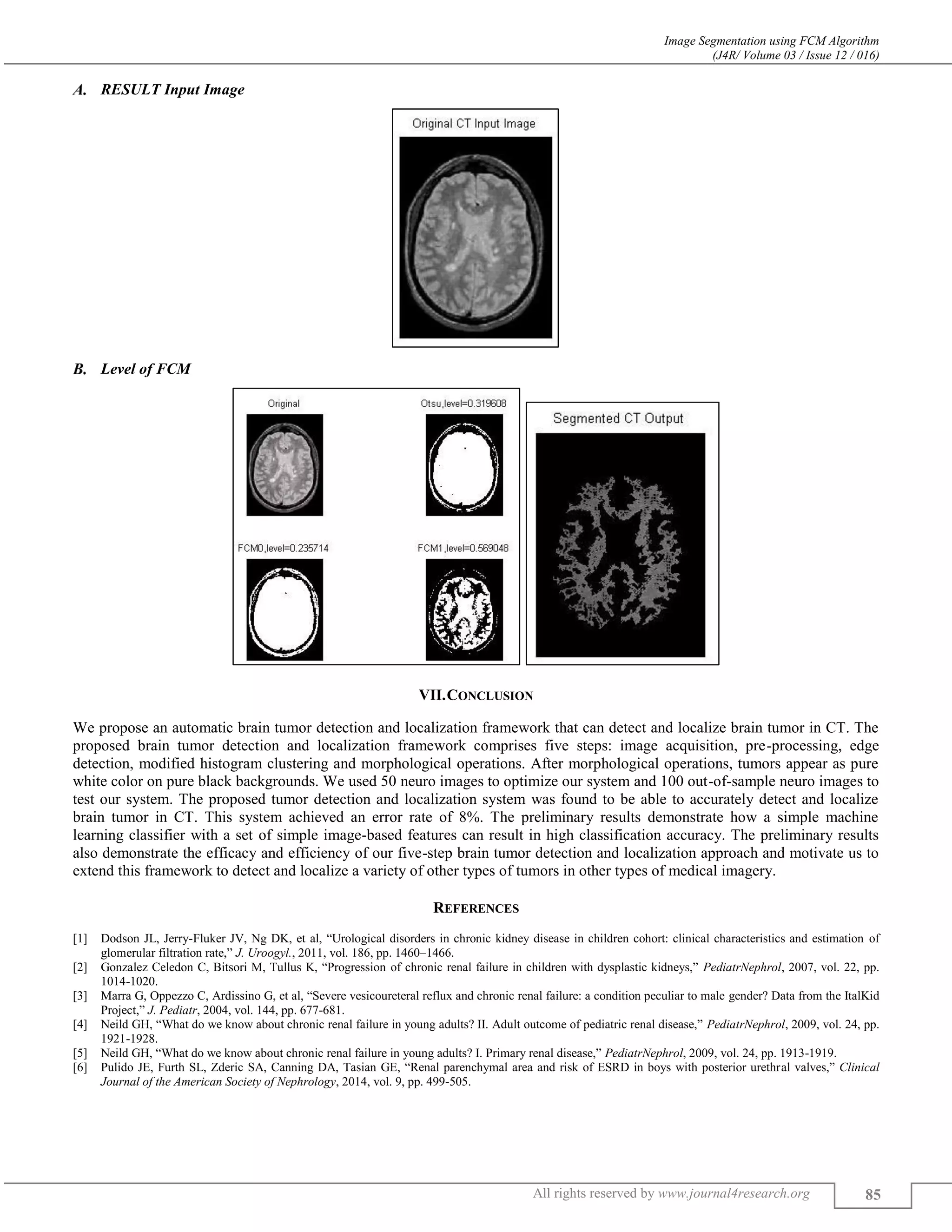 IMAGE SEGMENTATION USING FCM ALGORITM | J4RV3I12021 | PDF