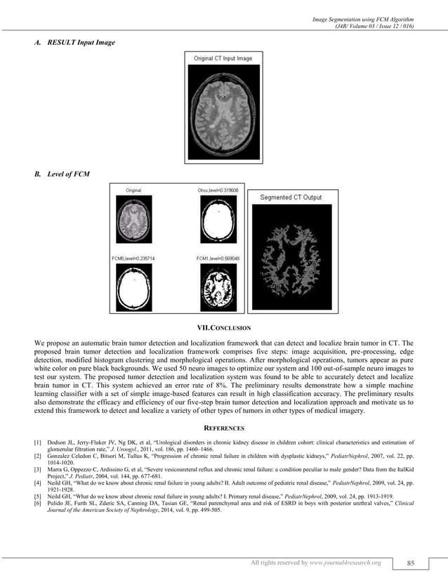 IMAGE SEGMENTATION USING FCM ALGORITM | J4RV3I12021 | PDF