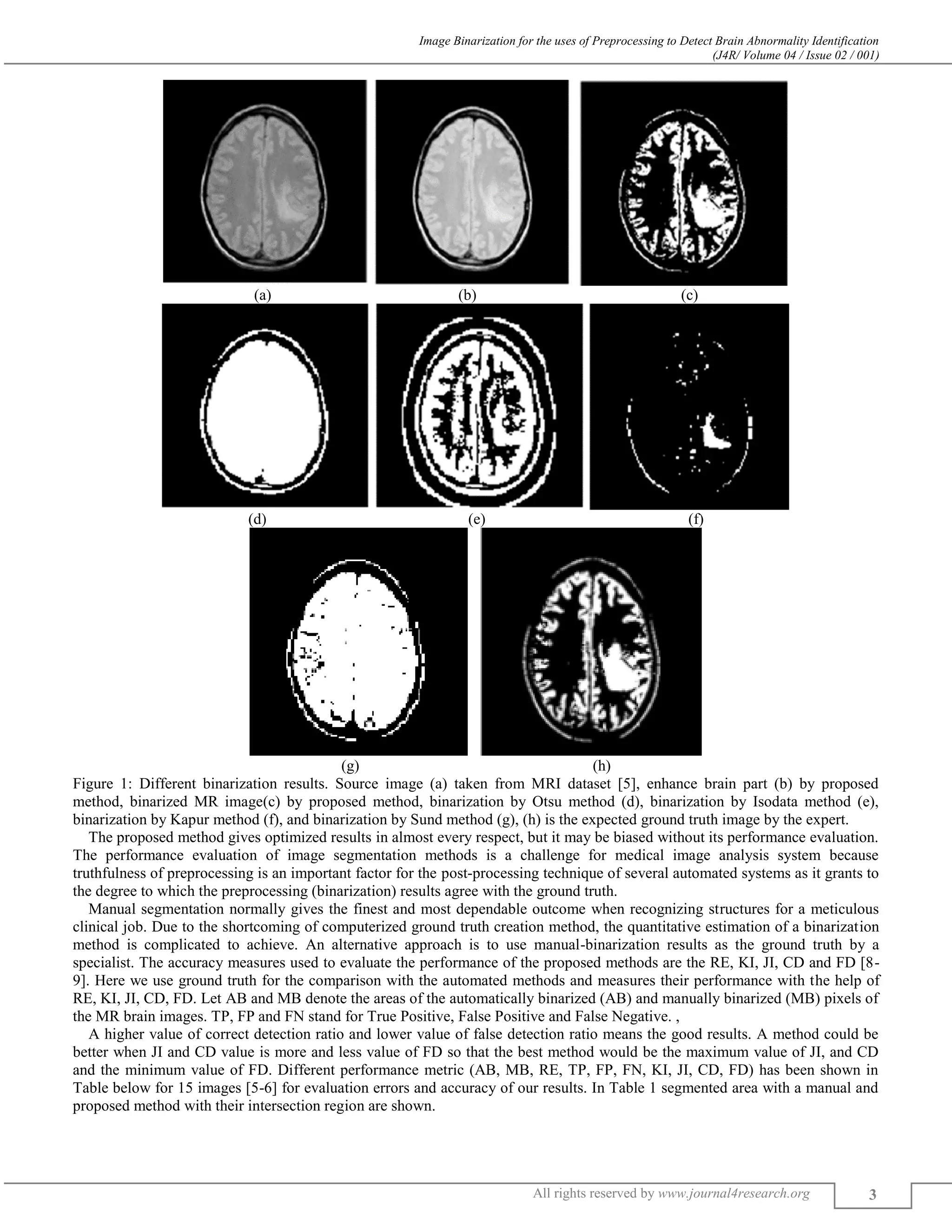 Image Binarization For The Uses Of Preprocessing To Detect Brain