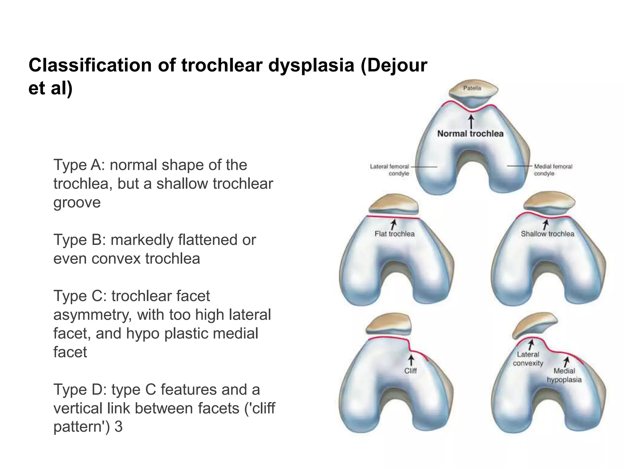 Patella dislocations | PPTX