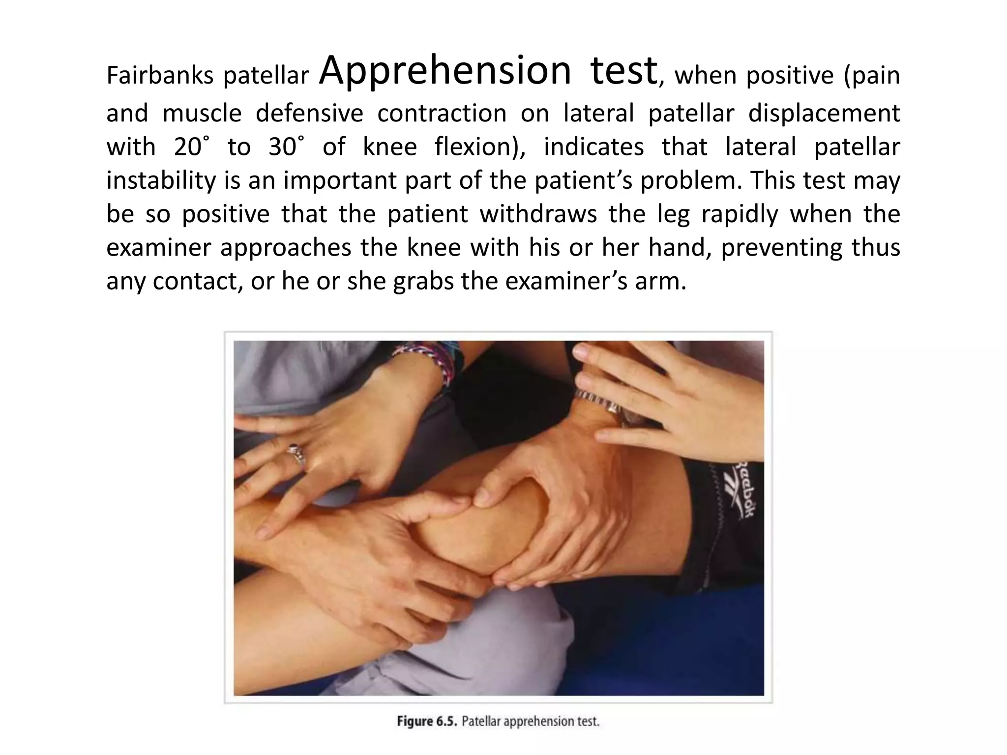 Patella dislocations | PPTX