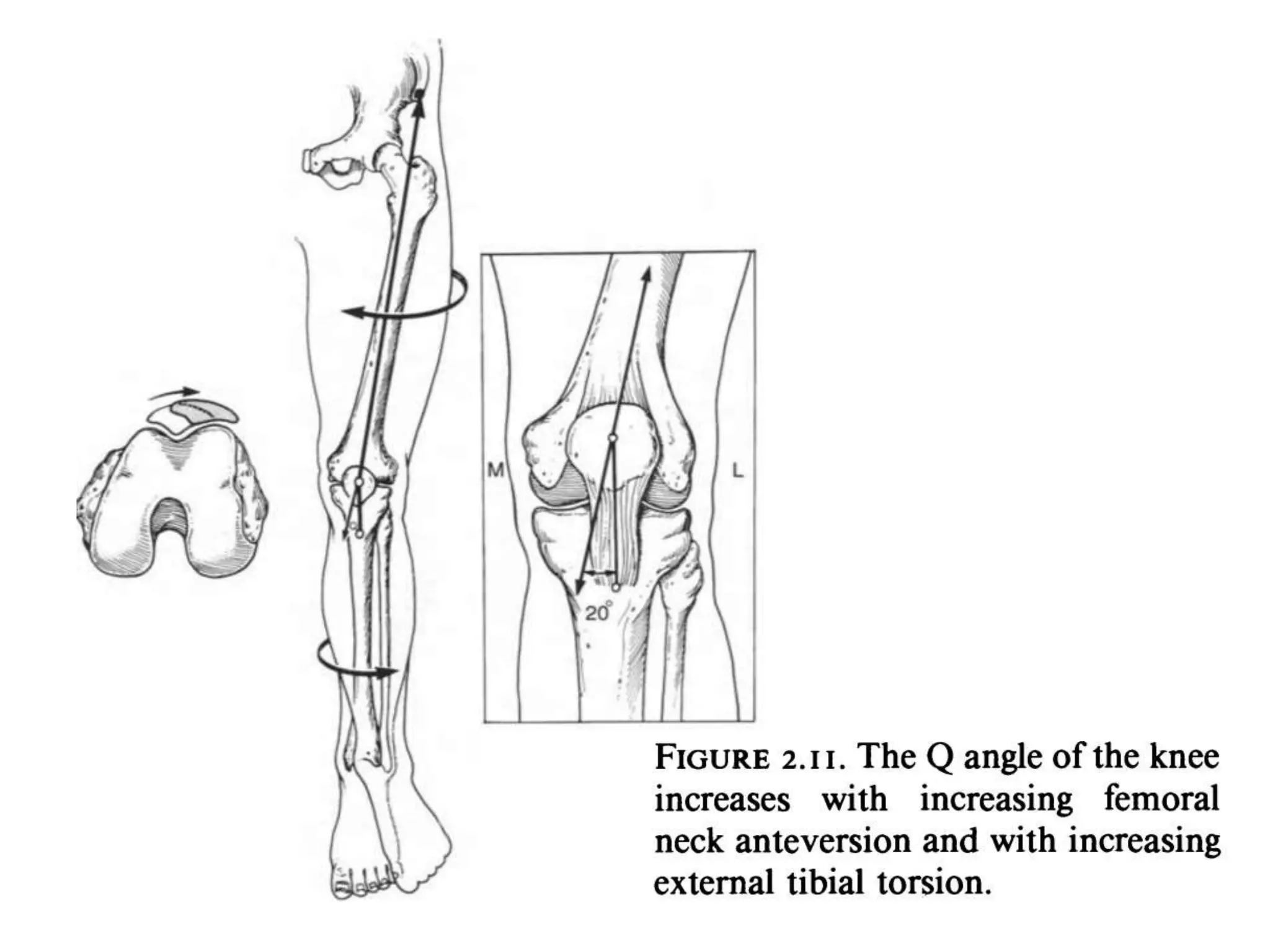Patella dislocations | PPTX
