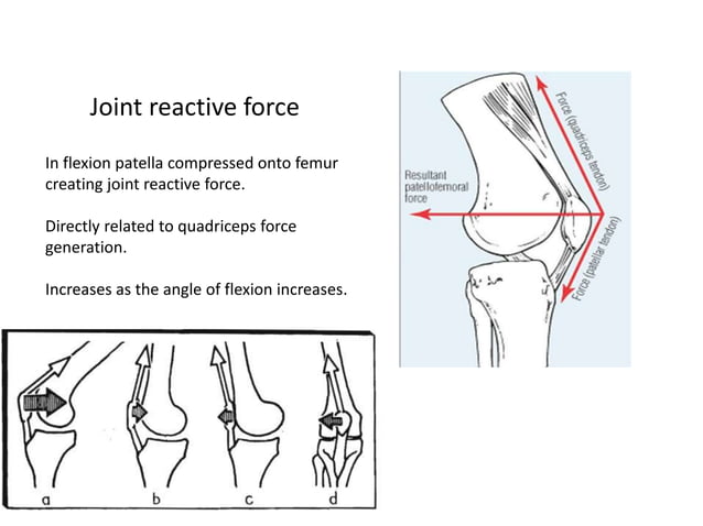 Patella dislocations | PPTX