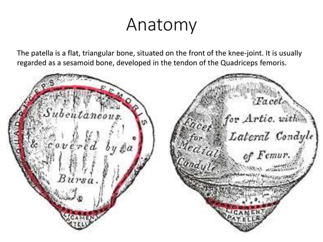 Patella dislocations | PPTX
