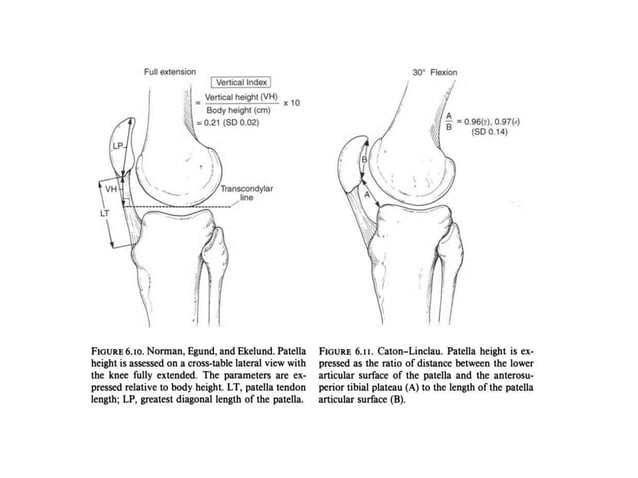 Patella dislocations | PPTX