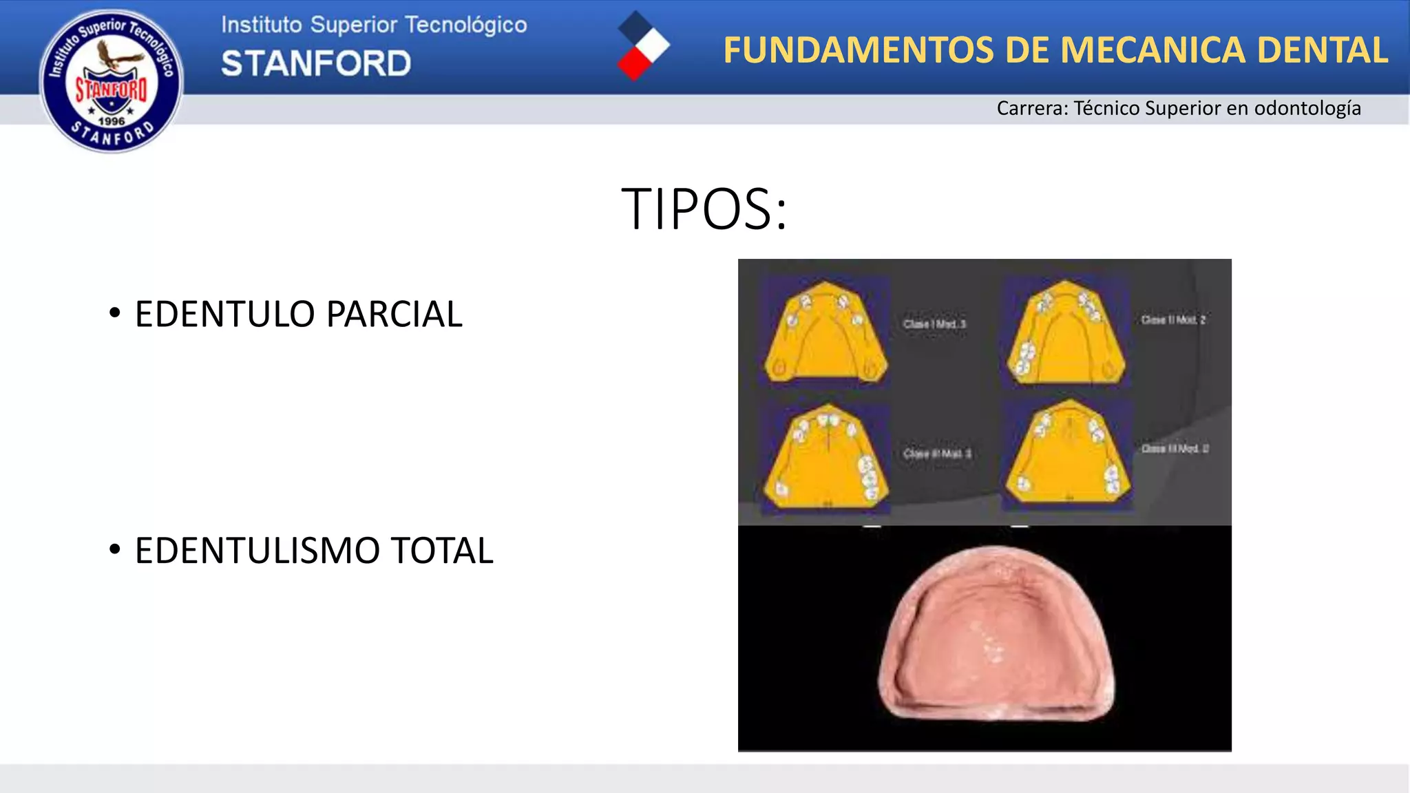 ANATOMÍA Y FISIOLOGÍA DEL EDÉNTULO COMPLETO | PPTX