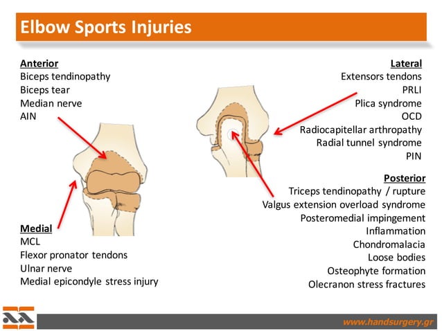 Elbow sports injuries | PDF