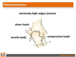 Elbow sports injuries | PDF