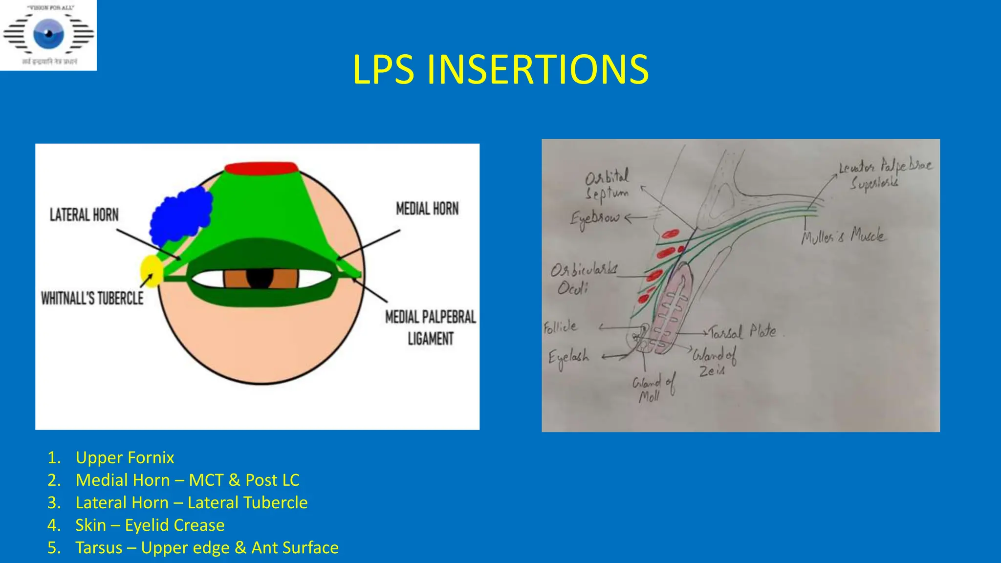 EYELID_ANATOMY presentation dhir bwn.pptx