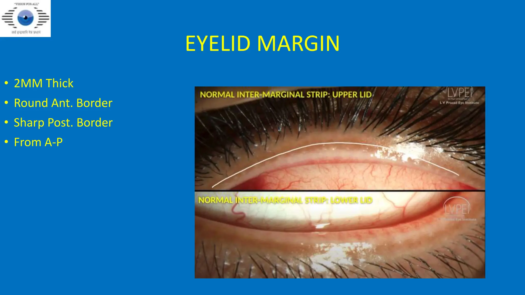 EYELID_ANATOMY presentation dhir bwn.pptx