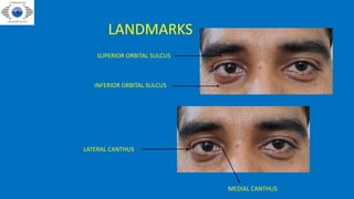 EYELID_ANATOMY presentation dhir bwn.pptx