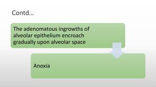 Jaagsiekte - Sulove Koirala | PPT