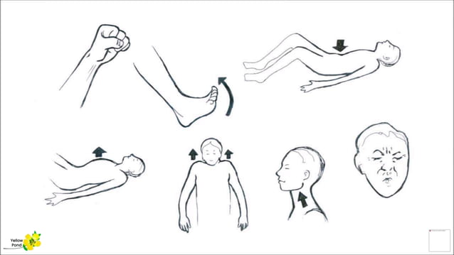 Jacobson's Progressive Muscle Relaxation Technique.pptx | Physical ...