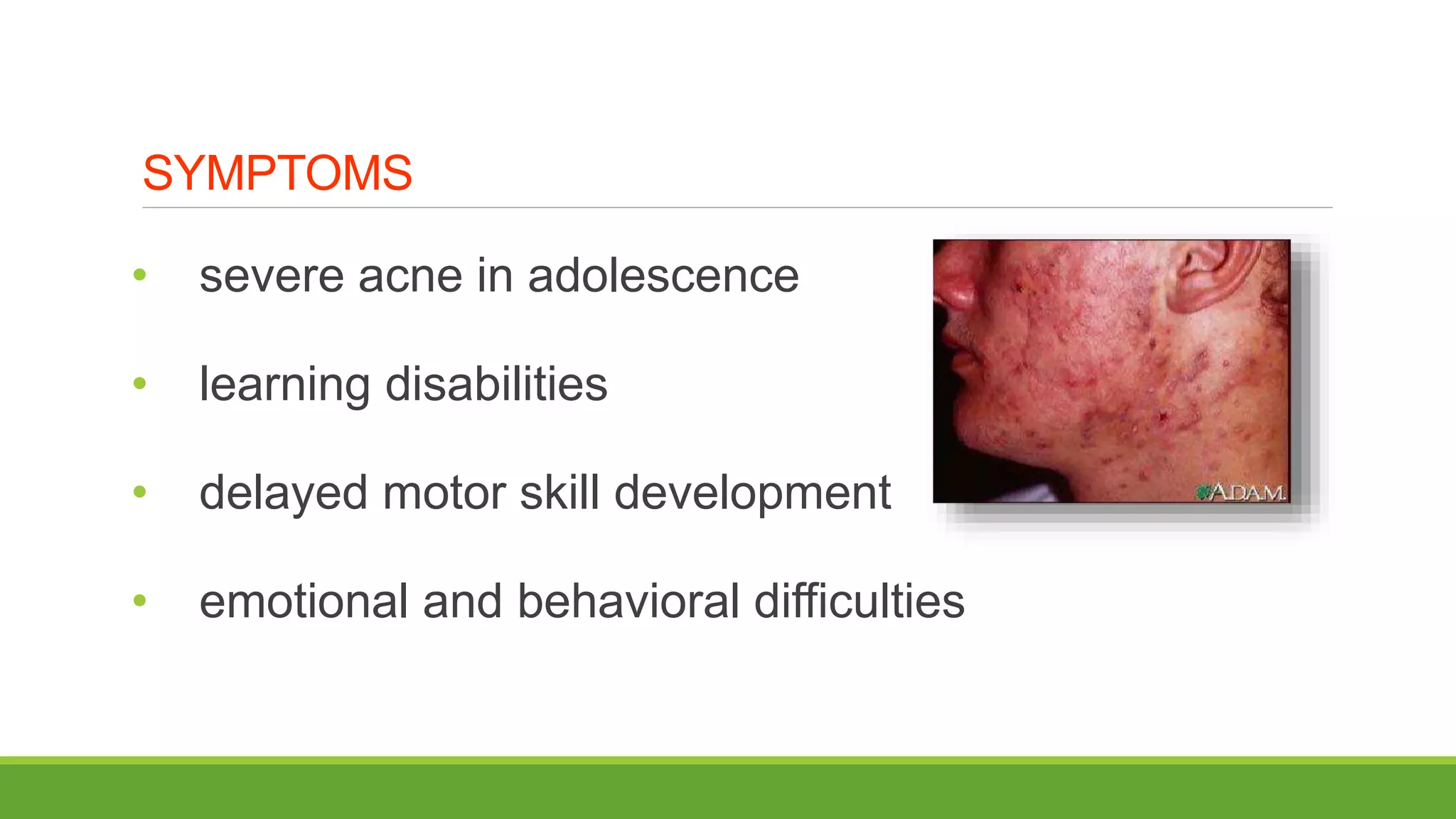 Jacob's syndrome | PPTX