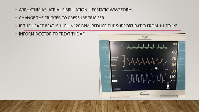 JAGAAN PESAKIT IABP.pptx | First Aid | Injuries