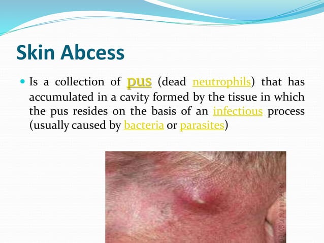 Skin and Soft Tissue Infections | PPTX
