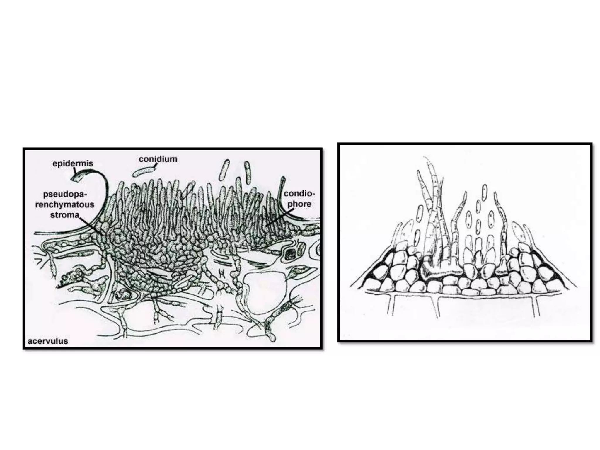 Asexual Fruiting bodies of fungi | PPTX