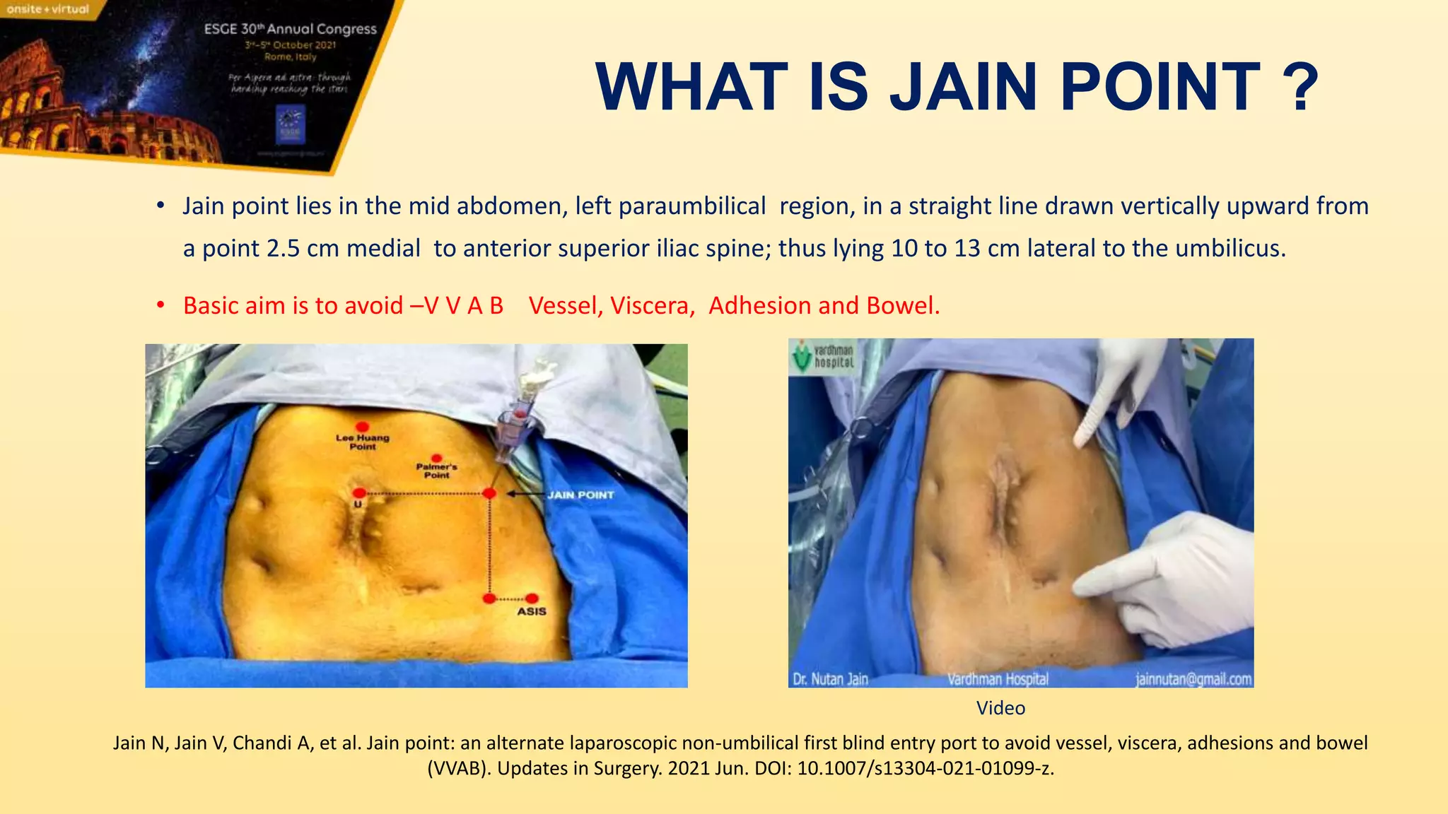 Jain point a viable option in contraindications of palmers point | PPT