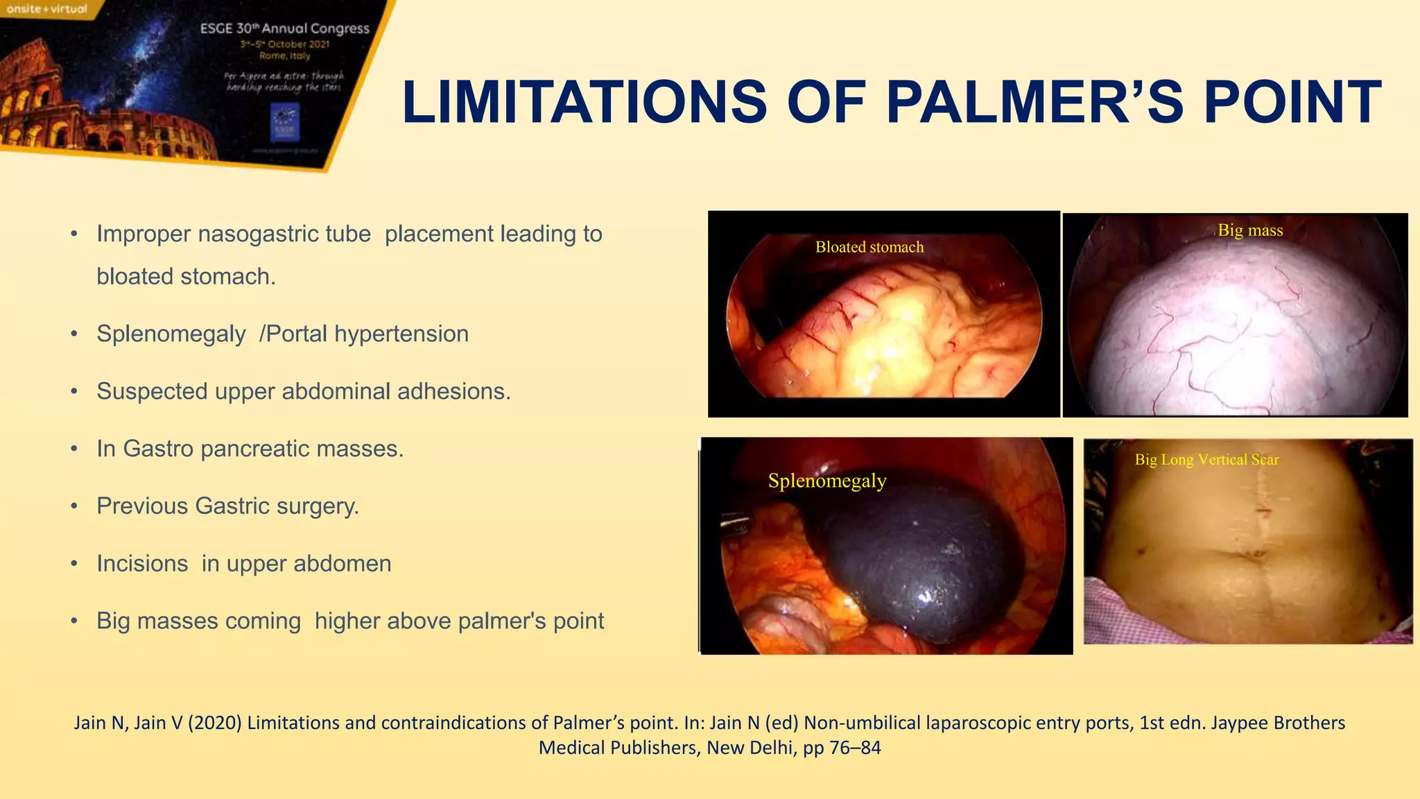 Jain point a viable option in contraindications of palmers point | PPTX ...