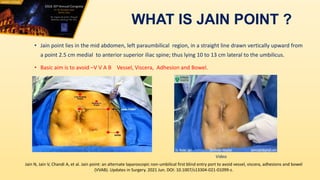 Jain point a viable option in contraindications of palmers point | PPTX