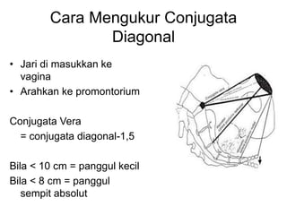 Jalan lahir normal & kala 3 & 4 | PPT