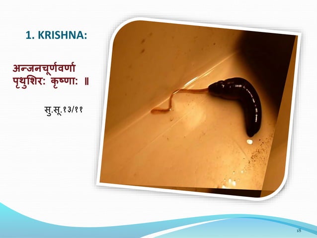 Jalaukavacharana - Leech Therapy in Ayurveda | PPTX | Blood Disorders ...