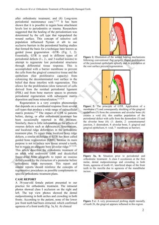 ORTHODONTIC TREATMENT OF PERIODONTALLY DAMAGED TEETH - AN ...