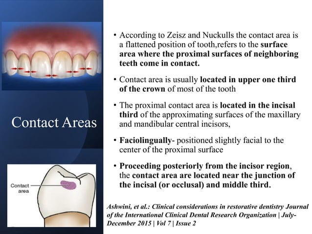 CONTACTS AND CONTOURS IN DENTISTRY | PPTX | Dental Health | Diseases ...