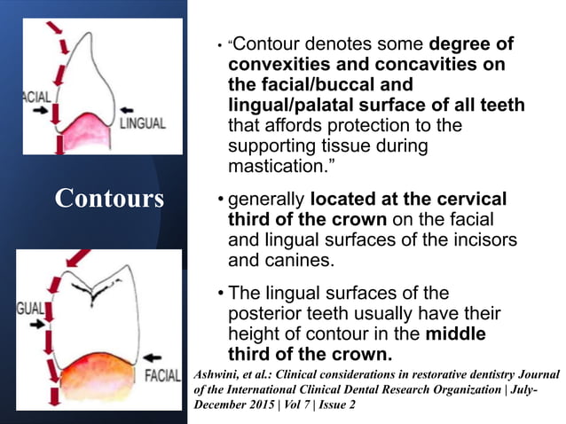 CONTACTS AND CONTOURS IN DENTISTRY | PPTX | Dental Health | Diseases ...