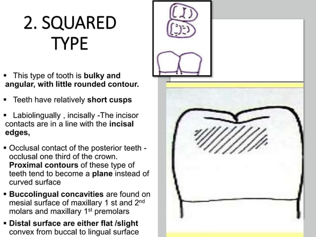 CONTACTS AND CONTOURS IN DENTISTRY | PPTX | Dental Health | Diseases ...